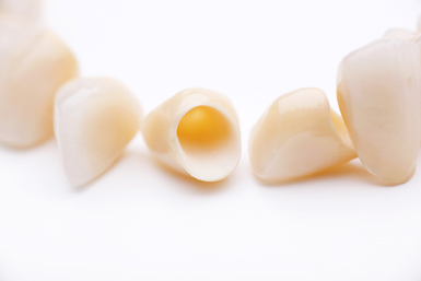 Vaste prothese – Dentifiek